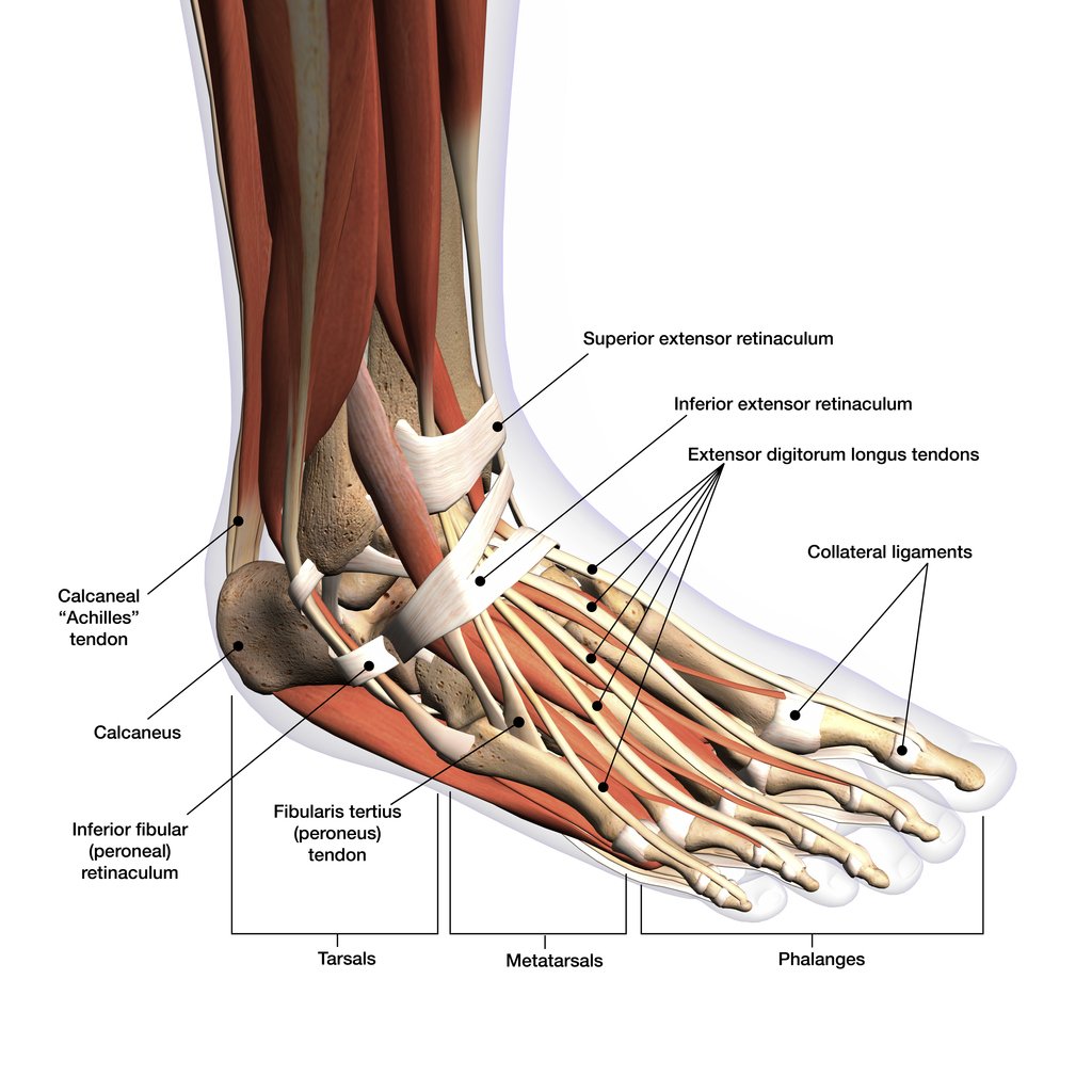 What Is Tendonitis 