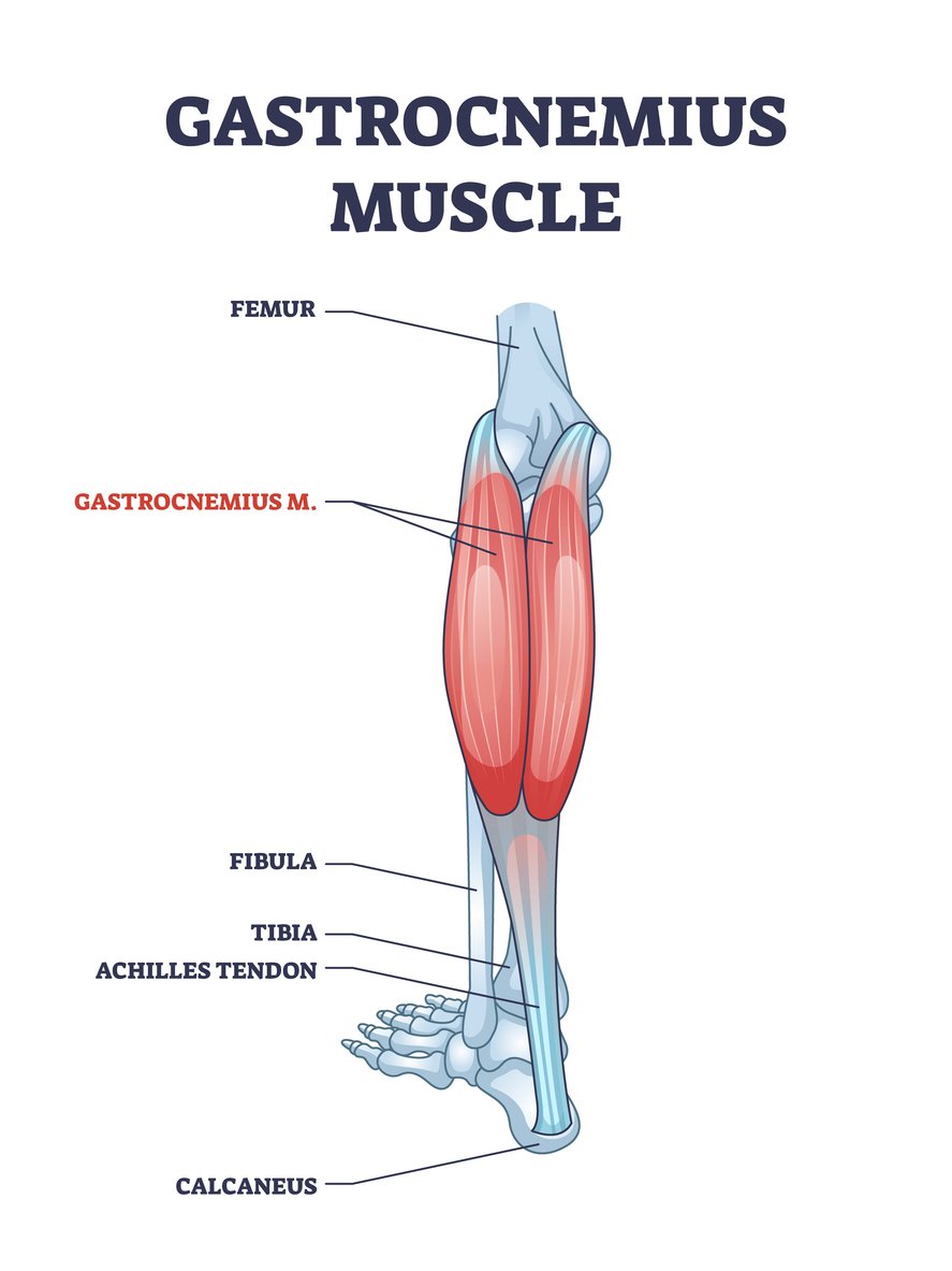 Gastrocnemius or Calf Tear